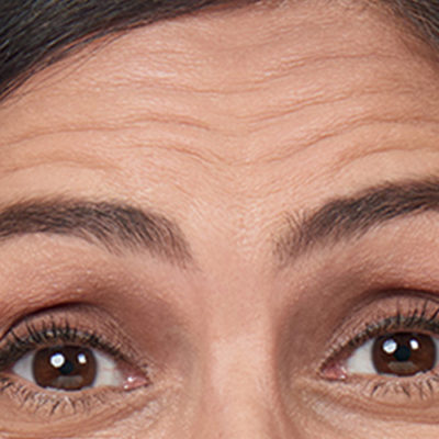 Artistik Beauty of Winter Park, FL | Botox Winter Park | Botox Orlando